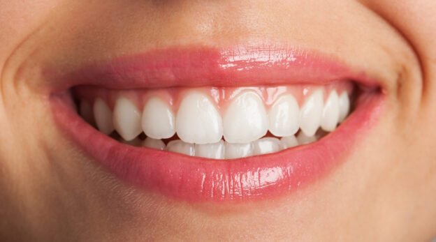 How to Achieve Your Ideal Smile Makeover by Combining Treatments - Texas Gentle Dental Care ...